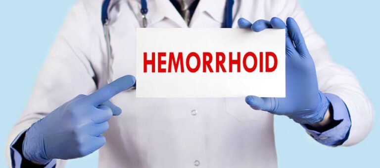 Types of Hemorrhoids | Digestive Disease Care (DDC)