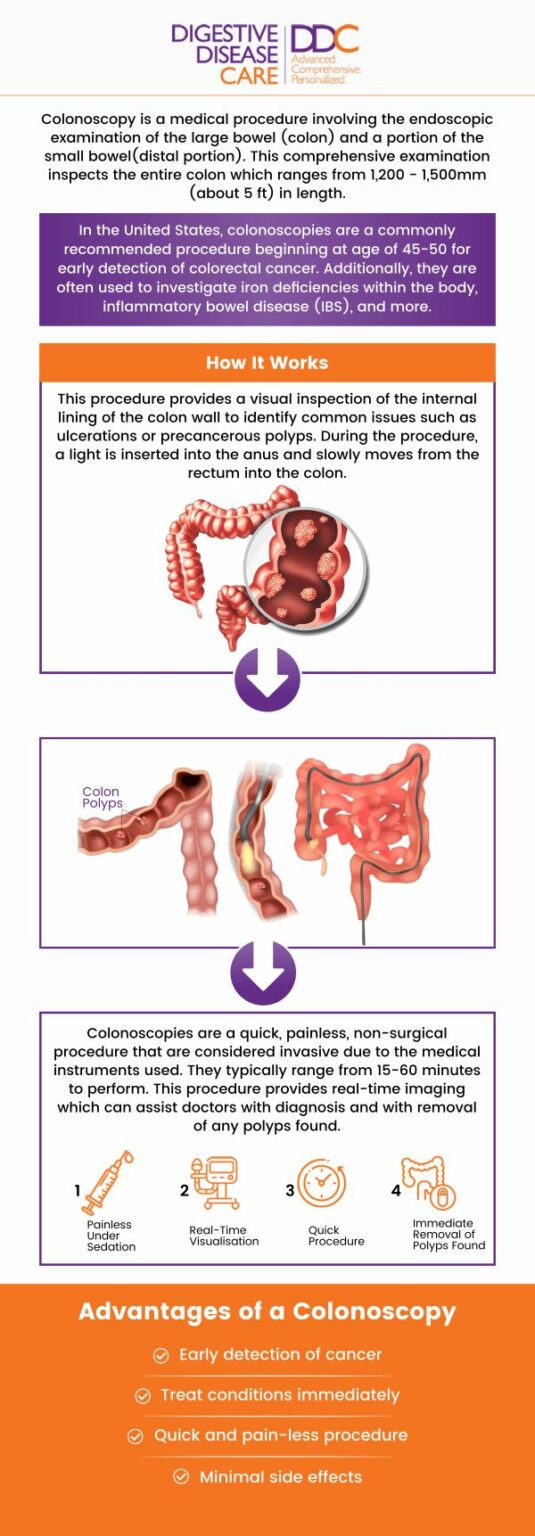 What You Need to Know About Colonoscopy Procedures