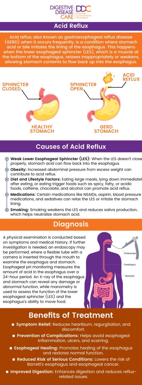 Acid Reflux vs. Heartburn: What’s the Difference?