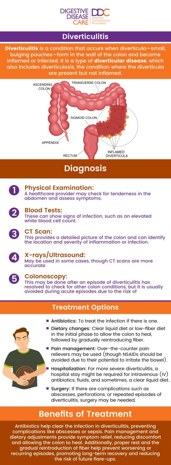 Diverticulitis: Symptoms Causes & Treatment | Multiple Locations