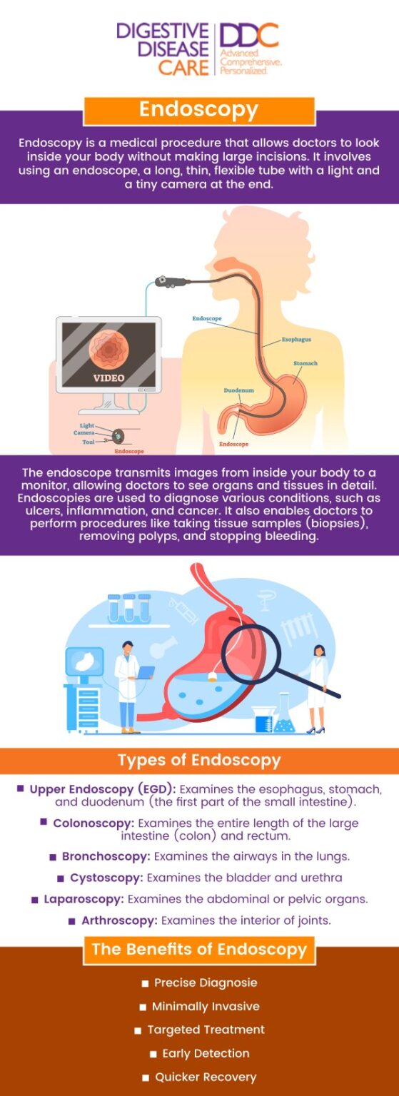 What Does an EGD (Upper Endoscopy) Diagnose?